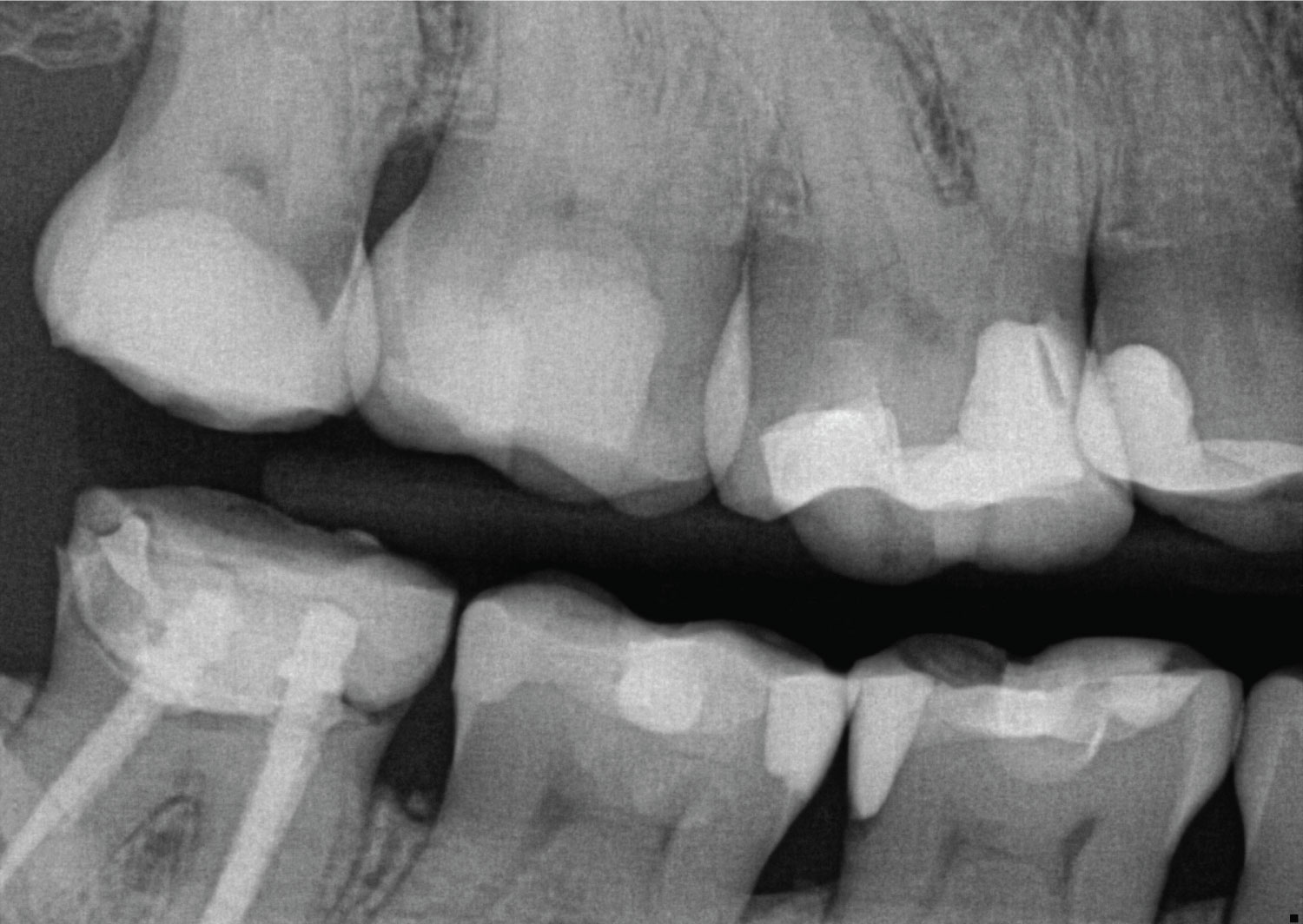Dental X-Rays at Our Calgary Dentist Office - Advance Your Health ...